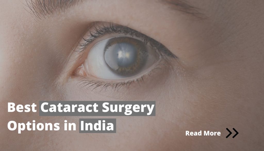 Best Cataract Surgery Options in India: Techniques & Costs