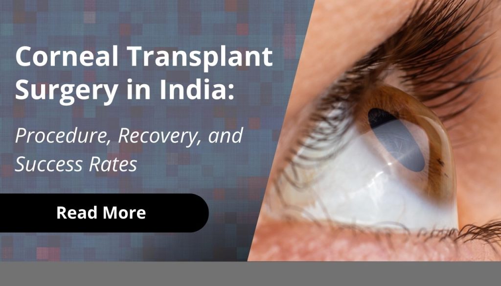 Corneal Transplant Surgery in India: Procedure, Recovery, and Success ...
