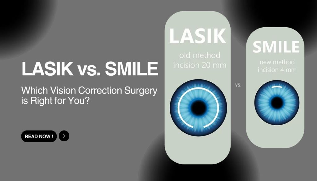 LASIK vs. SMILE: Which Vision Surgery Suits You? - Laxmi Eye Hospital