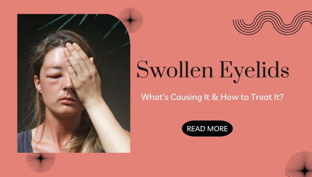 Swollen Eyelids: What’s Causing It and How to Treat It? - Laxmi Eye ...