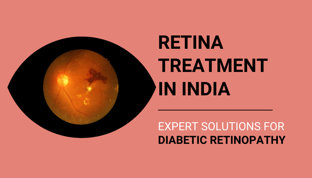 Retina Treatment in India: Expert Solutions for Diabetic Retinopathy ...