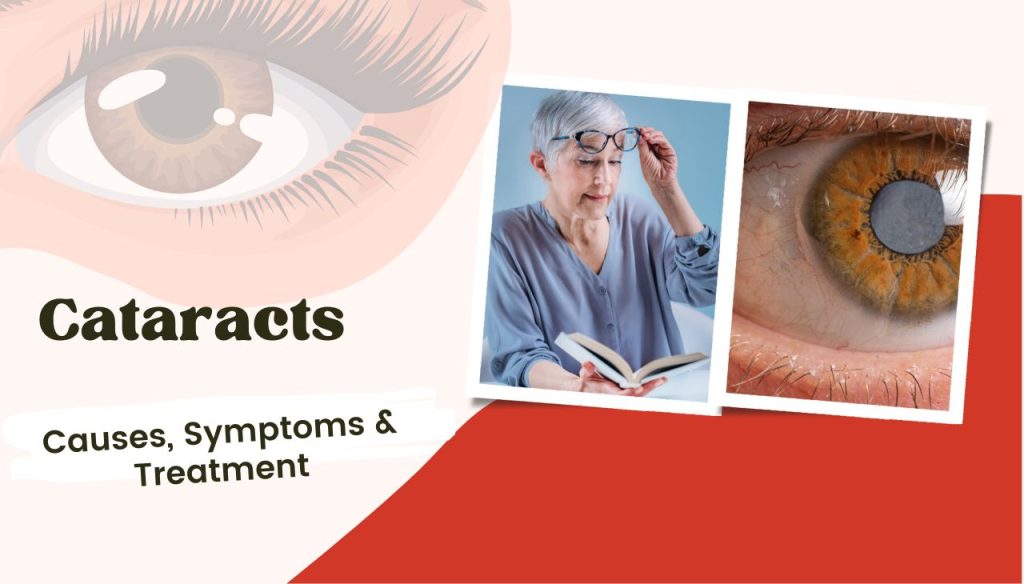 Everything You Need to Know About Cataracts: Causes, Symptoms & Treatment - Laxmi Eye Hospital