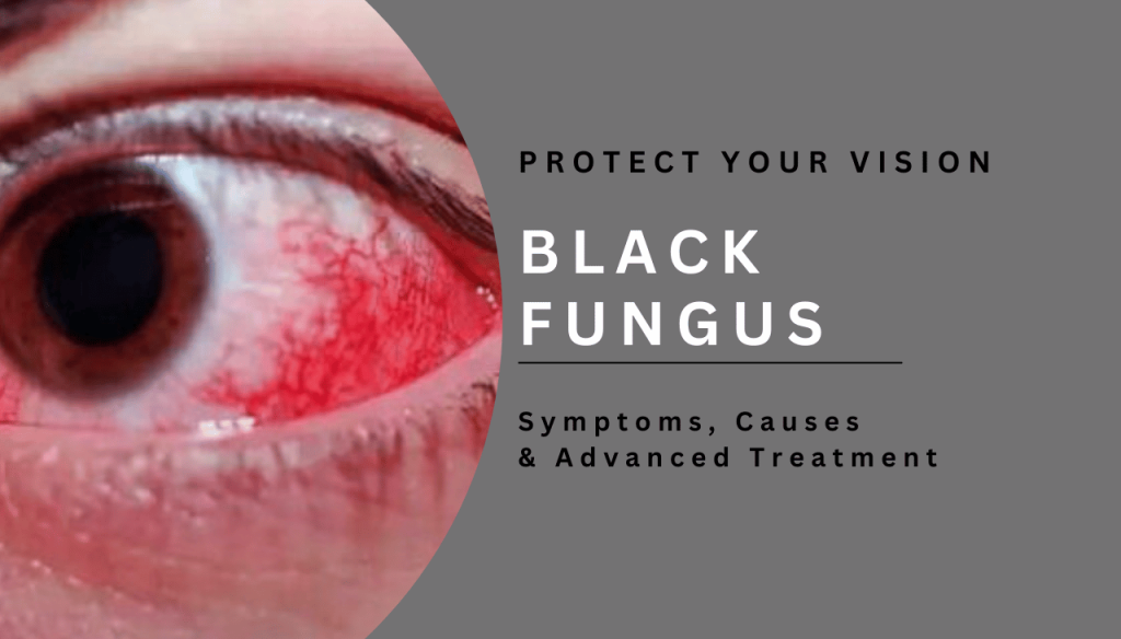 Black Fungus In Eye : Symptoms, Causes & Treatment - Laxmi Eye Hospital