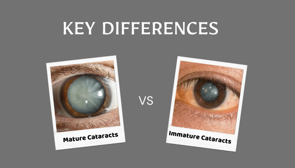 Mature vs. Immature Cataracts: Key Differences - Laxmi Eye Hospital