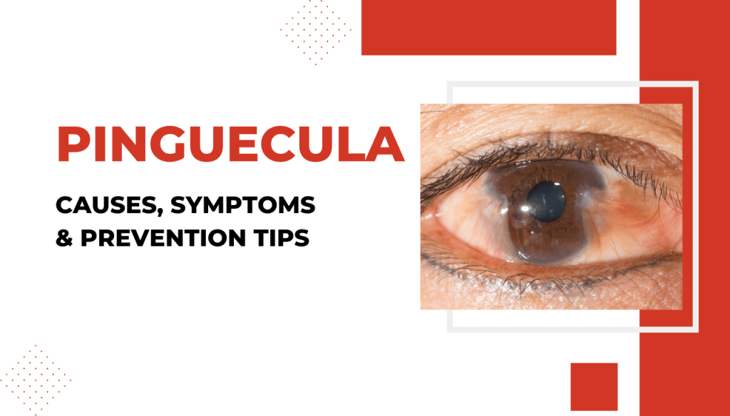 Pinguecula: Causes, Symptoms & Prevention Tips - Laxmi Eye Hospital