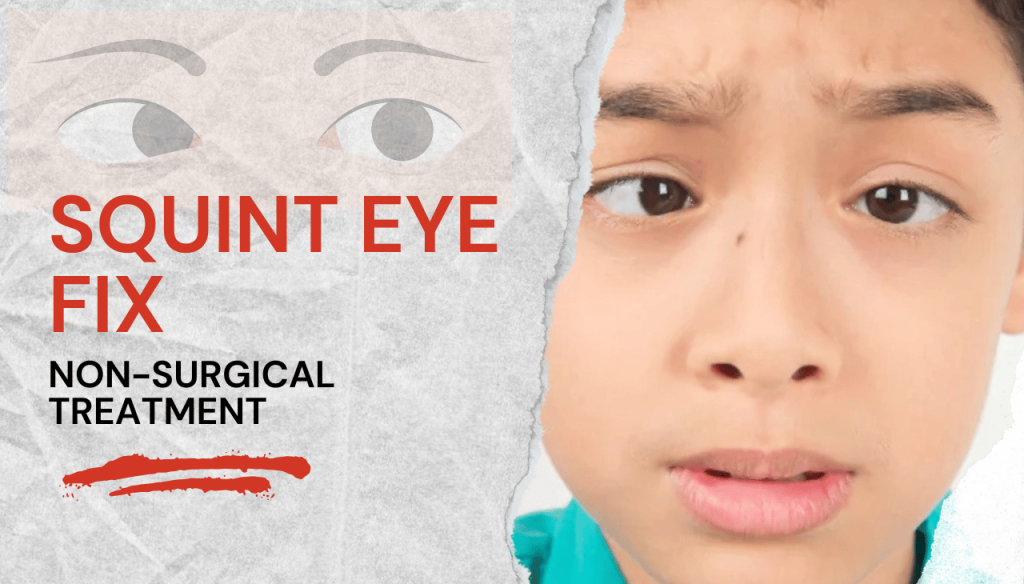 Squint Eye Fix: Non-Surgical Treatment Options - Laxmi Eye Hospital