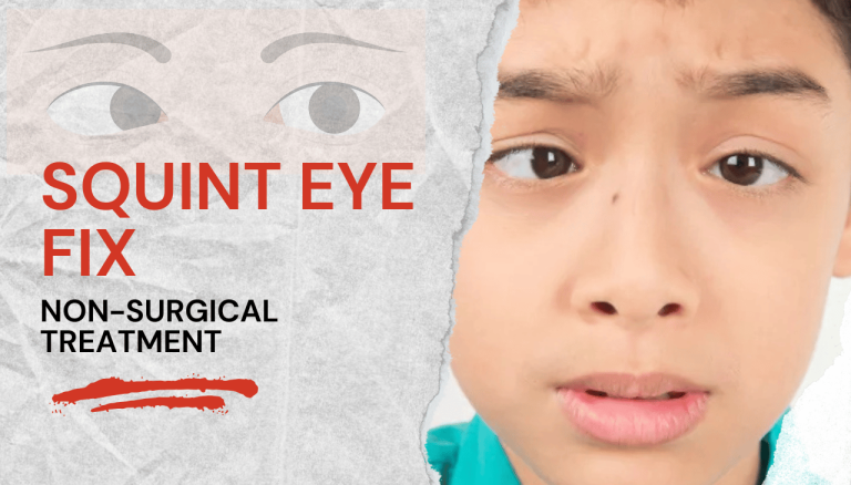 Squint Eye Fix: Non-Surgical Treatment Options - Laxmi Eye Hospital