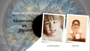 Strabismus vs. Squint: What Sets Them Apart? - Laxmi Eye Hospital