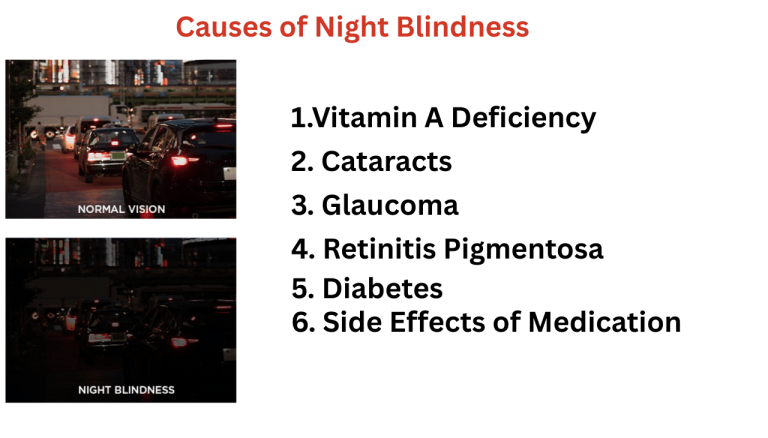 Night Blindness: Symptoms, Causes & Treatments - Laxmi Eye Hospital