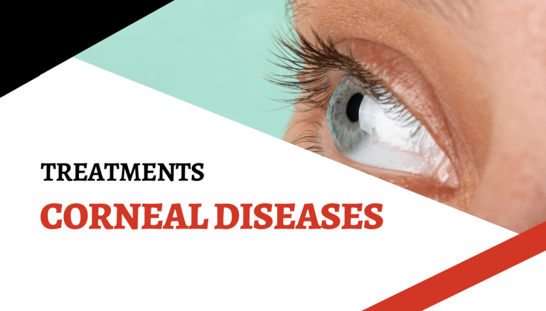 Corneal Diseases and Treatments: What You Need to Know - Laxmi Eye Hospital