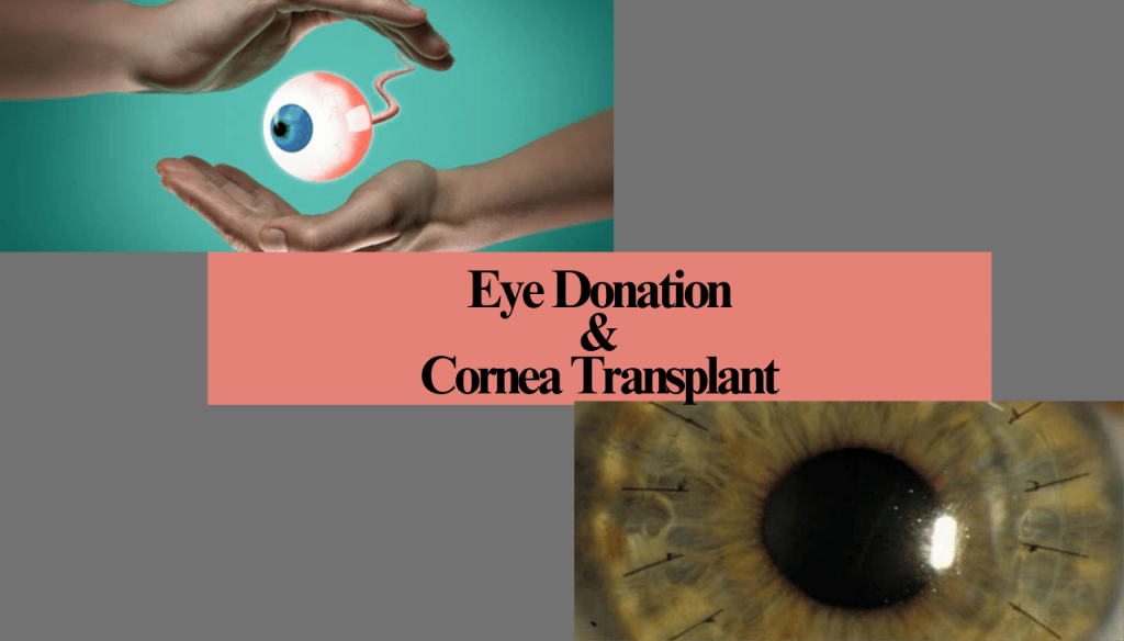 Eye Donation to Vision: Cornea Transplant Journey - Laxmi Eye Hospital