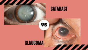 Glaucoma vs. Cataract: What’s the Difference? - Laxmi Eye Hospital