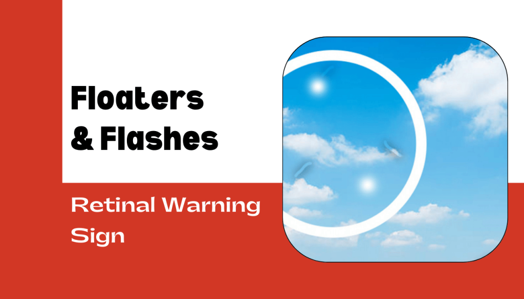 Floaters & Flashes: Is It a Retinal Warning Sign? - Laxmi Eye Hospital