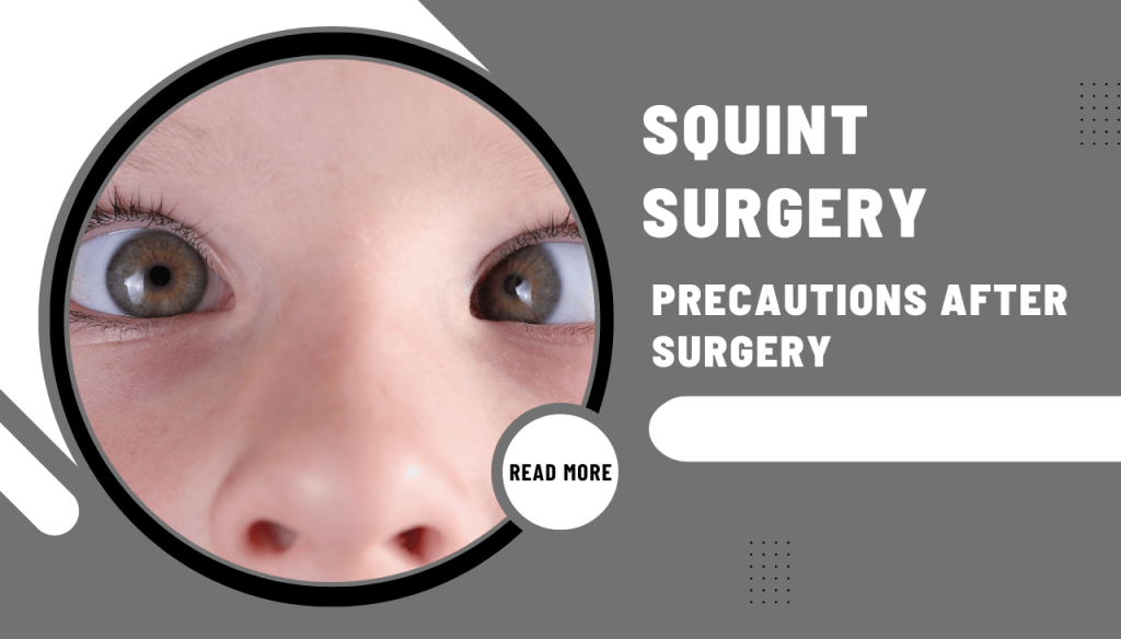 Precautions to Follow After Squint Surgery - Laxmi Eye Hospital