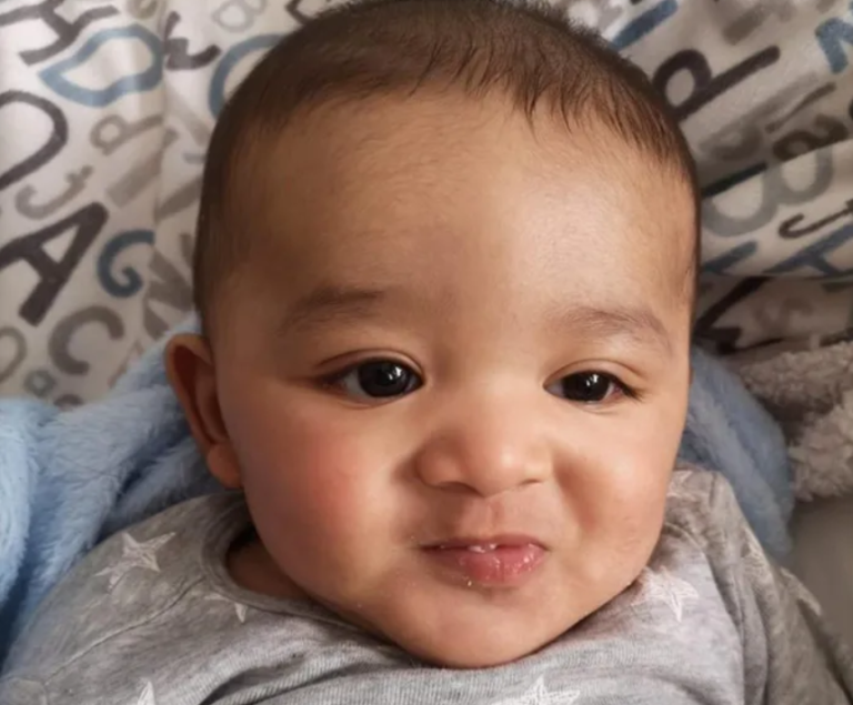 What is Optic Nerve Hypoplasia (ONH) in Babies ? - Laxmi Eye Hospital