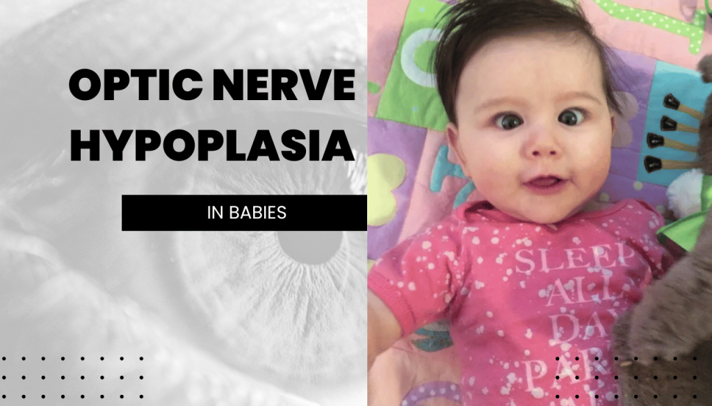 What is Optic Nerve Hypoplasia (ONH) in Babies ? - Laxmi Eye Hospital