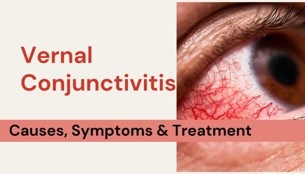 Vernal Conjunctivitis: Causes, Symptoms & Treatment - Laxmi Eye Hospital