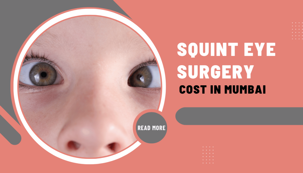 How Much Does Squint Eye Surgery Cost in Mumbai ? - Laxmi Eye Hospital