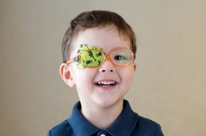 Can Amblyopia Be Caused by Strabismus? Understanding the Connection ...