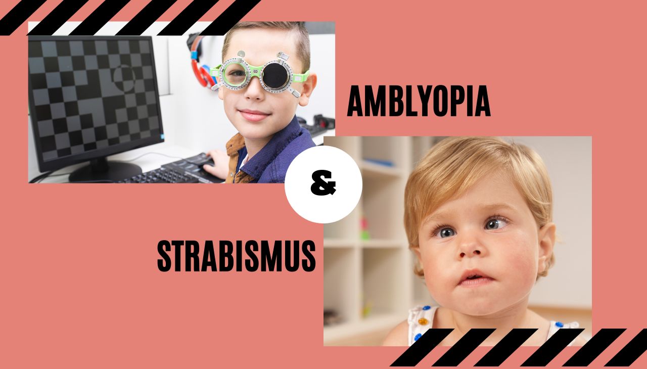 Can Amblyopia Be Caused by Strabismus? Understanding the Connection ...