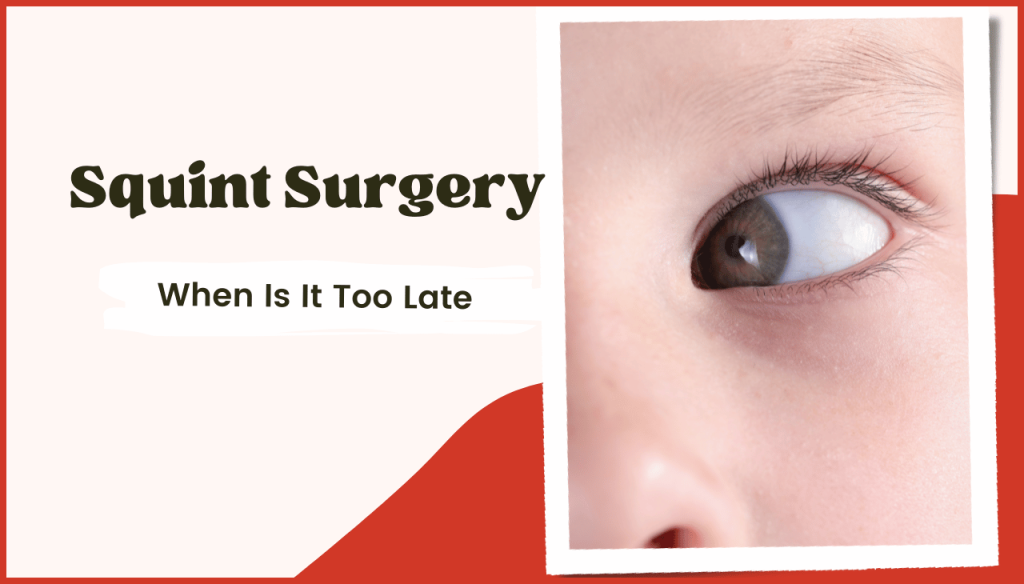 When Is It Too Late for Squint Surgery? Understanding Age Factors ...