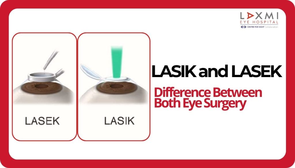 Difference Between LASIK and LASEK Eye Surgery - Laxmi Eye Hospital