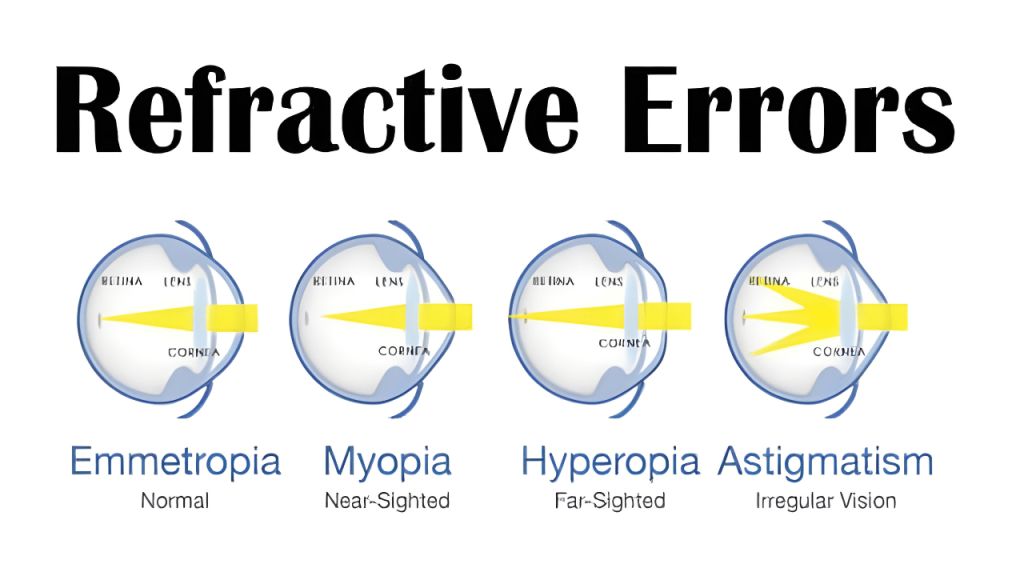 Why Does Vision Get Blurry? Top Medical Causes Explained - Laxmi Eye ...